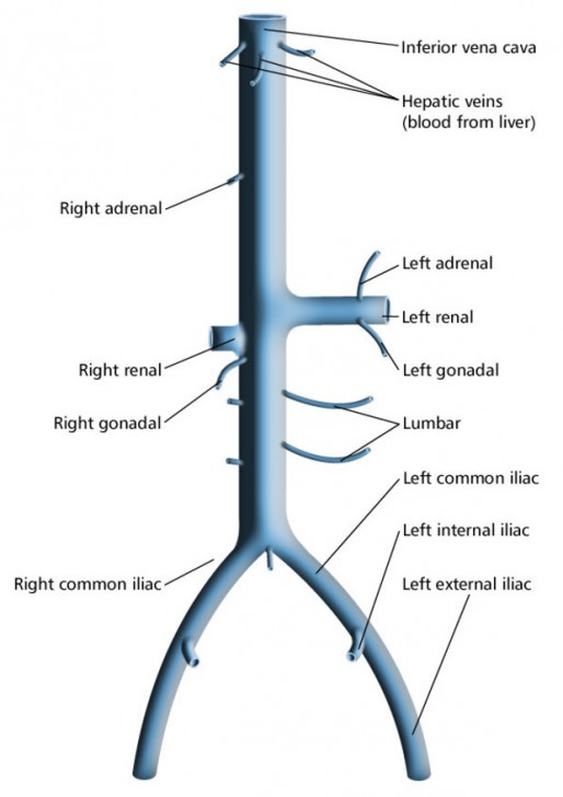 Inferior Vena Cava Syndrome