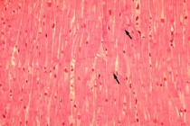 intercalated discs - ModernHeal.com