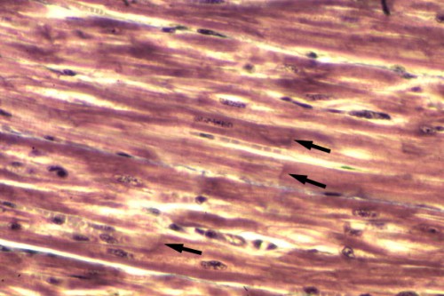 intercalated discs and striations - ModernHeal.com