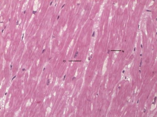 intercalated discs are found in - ModernHeal.com