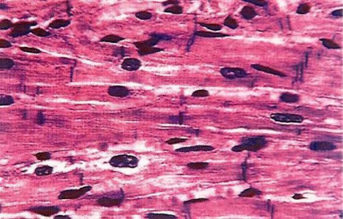 intercalated discs are present in smooth muscles - ModernHeal.com